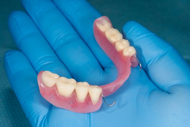 5 Permanent Tooth Replacement Options After Extraction - Divine Magazine